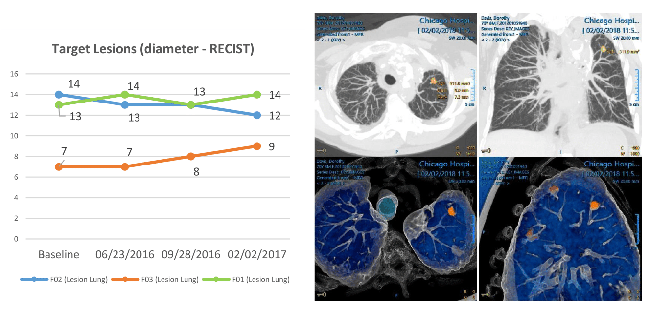 Seis innovaciones en el flujo de trabajo de radiología - Blog | Philips